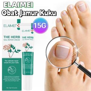 Jual 100% Efektif ELI Obat Jamur Kuku Perawatan Jamur Kuku Paronychia ...