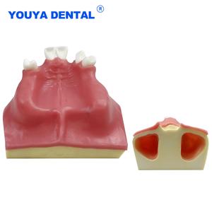 Jual Implant Teaching Implant Model Upper Jaw Maxillary Sinus Model For ...