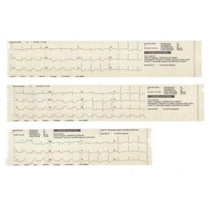 Jual Mindray EKG Paper Roll 80 x 25 mm - Kab. Bandung - kiokiokioyo ...