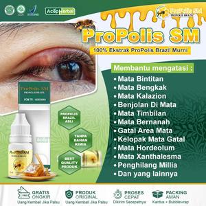 Jual Obat Mata Bintitan Benjolan Di Mata Mata Kalazion Mata Timbilan ...