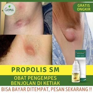 Jual Obat Buat Benjolan Di Ketiak - Obat Oles Benjolan Di Ketiak, Obat ...