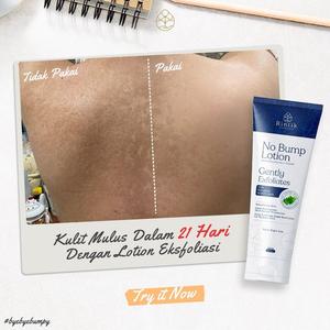 Jual Pcoi - Ready Rintik No Bump Lotion 100Ml | Lotion Tubuh Kulit ...
