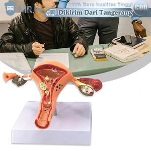 Jual Manekin Rahim 1set Alat Peraga Model Anatomi Uterus And Ovaries ...