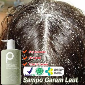 Jual 500ML Anti Ketombe Anti Gatal Pengobatan Folikulitis Menghilangkan Kotoran Dan Penumpukan ...