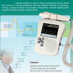 Jual Vascular Ultrasound Doppler Blood Flow Rate Detector Detect ...