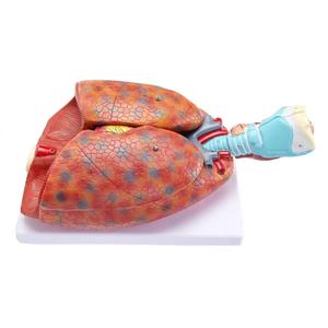 Jual Model Paru-Paru Manusia Ukuran 7 Bagian Model Anatomi Sistem ...