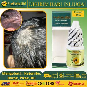 Jual Propolis Sm Obat Psoriasis Kulit Kepala - Gatal Kepala - Kulit Kepala Berkerak Berjamur ...