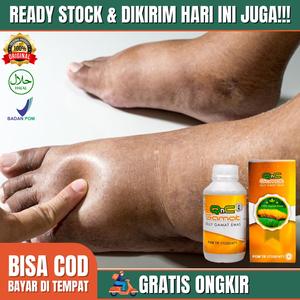 Jual Obat Kaki bengkak & Nyeri, Obat Bengkak Pada Kaki, Obat Buat Kaki ...