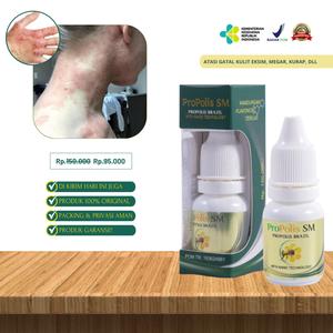 Jual Obat Kulit Gatal Eksim, Obat/Salep Eksim Ekcim Exim Excim Basah ...