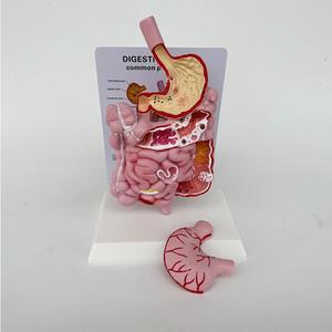 Jual Human Digestive System Anatomical Model Rectum Duodenum Human ...