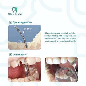 Jual twin matrix anterior / tor original / matriks / matrices proximal ...
