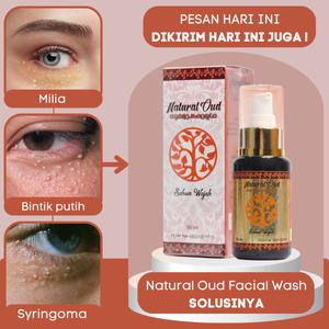 Jual Natural Oud Facial Wash - Obat Milia|Syringoma|Obat Oles Milia ...