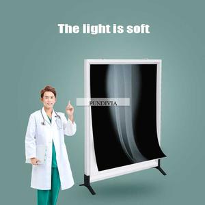 Jual X Ray Viewer Light Box X-Ray Lampu Baca Ronsen Rontgen Untuk ...