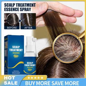 Jual Best Hair Growth Follicle Damage Hair Root Repair Stronger Thicker ...