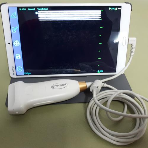 Jual USG portable USG smartphone mini usg convex linear probe usg probe ...