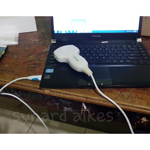 Jual USG PORTABLE Sonostar (mengunakan monitor Laptop) - Kota Makassar ...