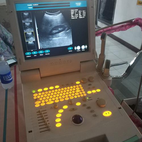 Jual USG 2D Color Doppler - Kab. Bekasi - DOKTShop | Tokopedia