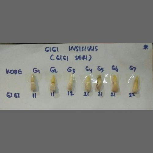 Jual KARIES Gigi asli manusia / gigi praktikum / gigi seri / gigi ...