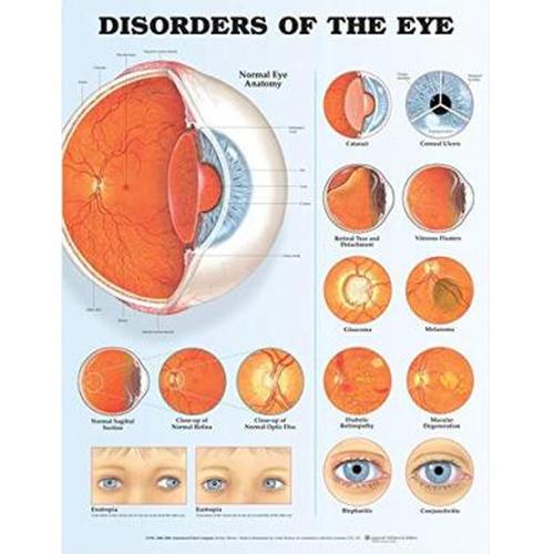 Jual Disorders of the Eye Anatomical Chart - Kab. Bekasi - Kerajaan ...