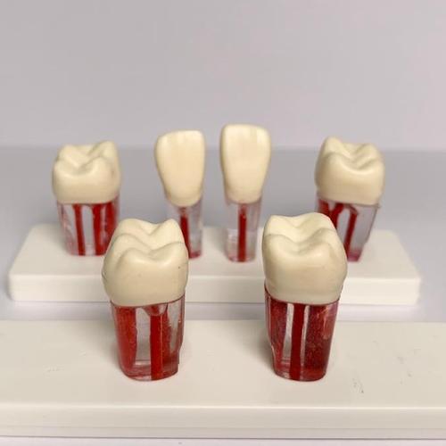 Jual Model Gigi Endodontic dengan Saluran Akar - Gigi 21 - Kota ...