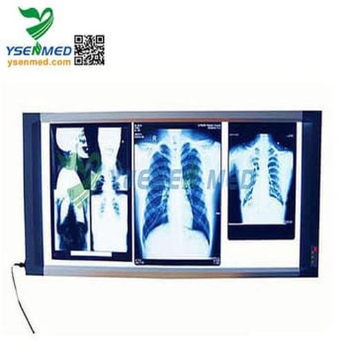 Jual SERVICE X-RAY FILM VIEWER - MAINTENANCE X-RAY FILM VIEWER - Kab ...