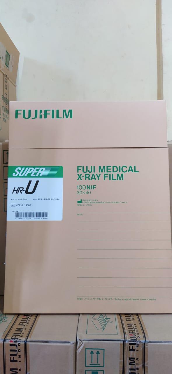 Jual FIlm Rontgen Konvensional Fujifilm 30 x 40 cm - Kab. Tangerang ...