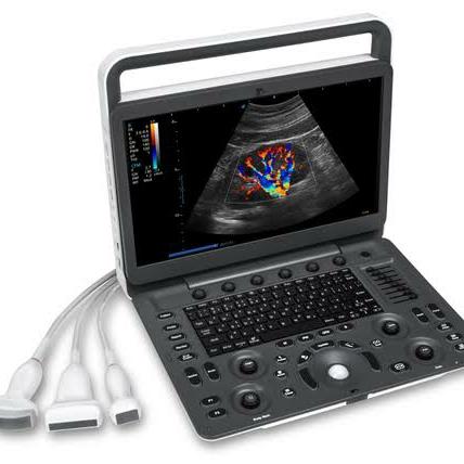 Jual USG Echo Ultrasound 2D Sonoscape E2 Cardiac - Jakarta Pusat - MoeL ...