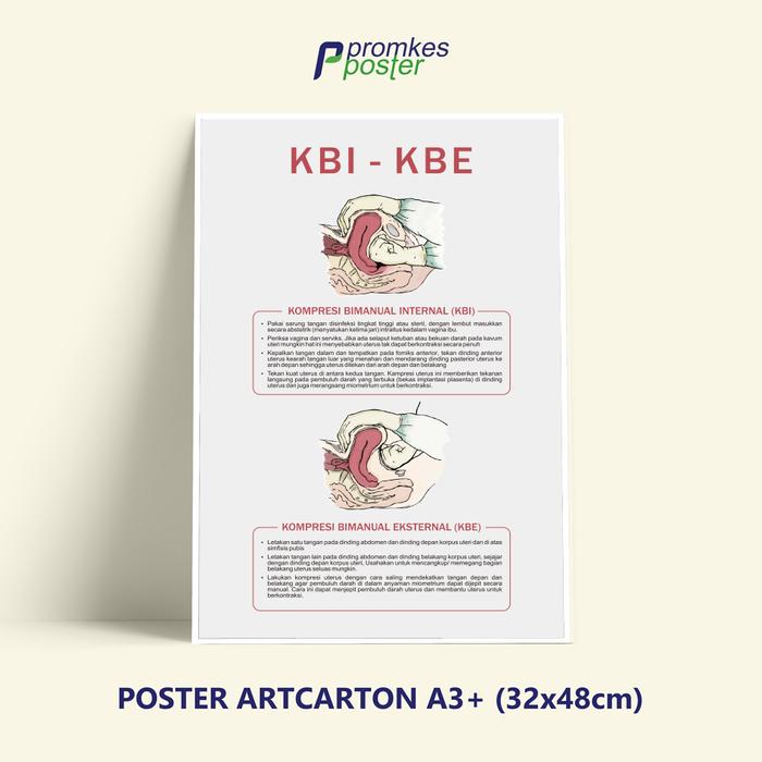 Jual Poster Kebidanan KBI KBE Kompresi Bimanual Interna Externa - Kab. Tangerang - promkesposter ...