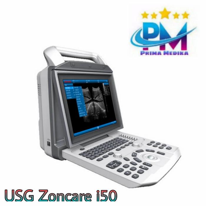 Jual USG Zoncare i50 Convex Probe / Alat USG 2 Dimensi - Kota Bekasi ...