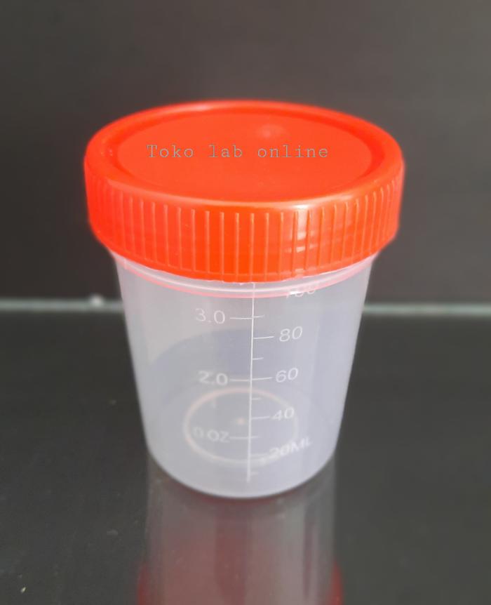 Jual Urine Container 100ml Sterile / Pot urine sterile - Kota Bandung ...