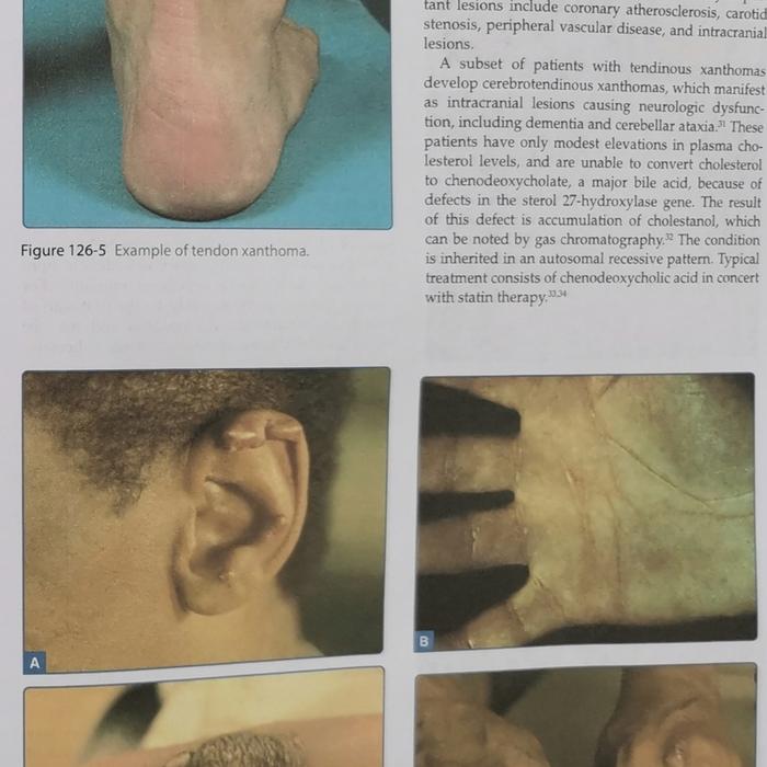 Jual Buku Kedokteran Fitzpatrick Dermatology 9e 2019 Di Seller Noelle ...