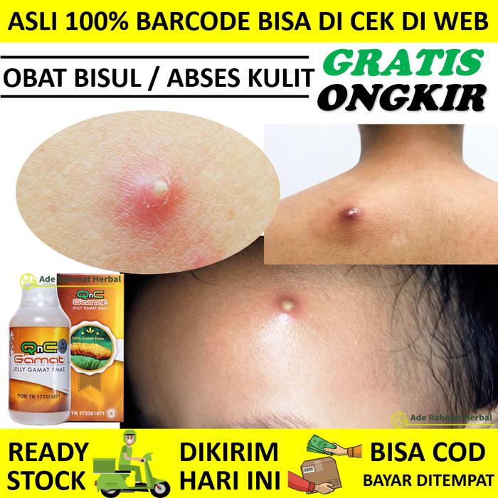 Jual Obat Bisul Bernanah, Bisulan, Abses Kulit Tradisional QnC Jelly Gamat - Kota Tangerang ...