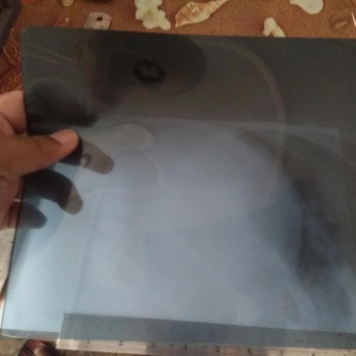Jual Sudip / kertas rontgen bekas ukuran 17,5 x 21,5 cm - Kota Medan ...