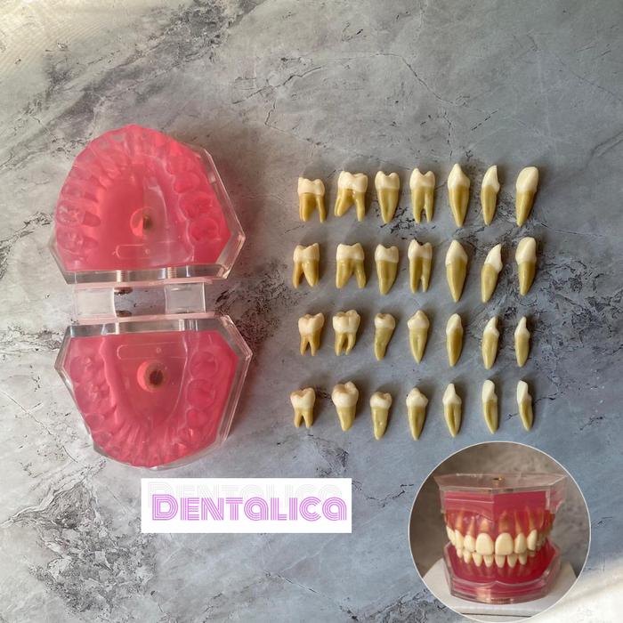 Jual Dental phantom gigi tiruan/ model study replika gigi lepasan lepas ...
