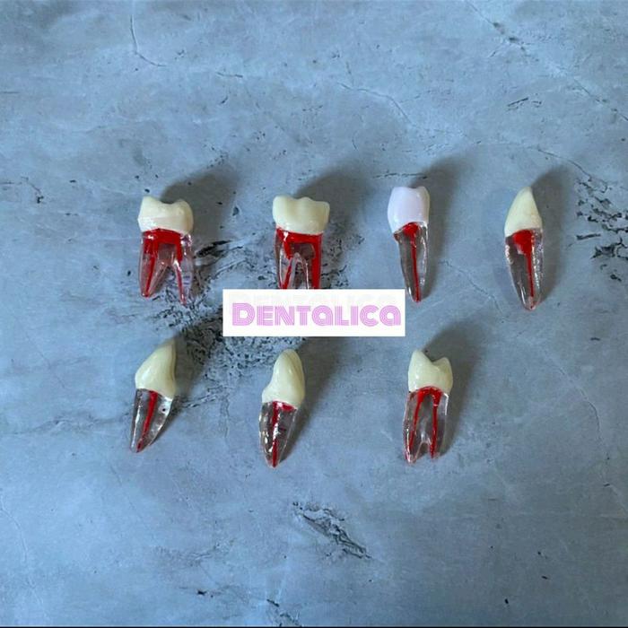 Jual 1pcs Dental model gigi saluran akar / root canal / elemen gigi ...