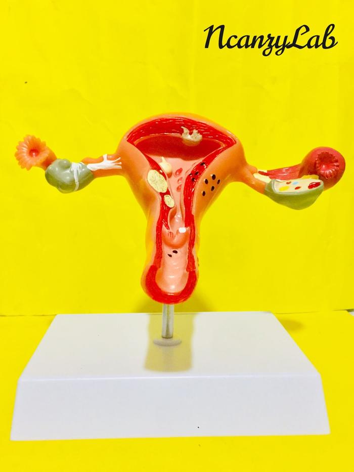 Jual Alat Peraga Anatomi Rahim /Uterus and Ovaries ( Normal ...