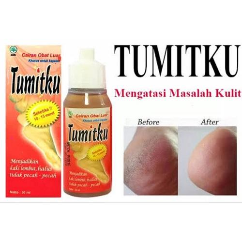 Jual Obat Tumitku penghilang kapalan/pecah-pecah pada kulit telapak ...