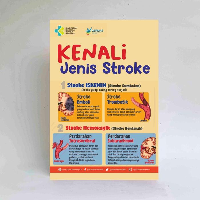 Jual Poster Kesehatan, Kenali Jenis-jenis Stroke - Kab. Bandung - Nahapitu | Tokopedia
