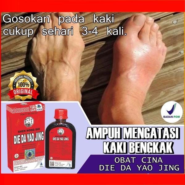 Promo Obat Untuk Kaki Bengkak Keseleo Sakit Ampuh Mengempeskan Asli ...
