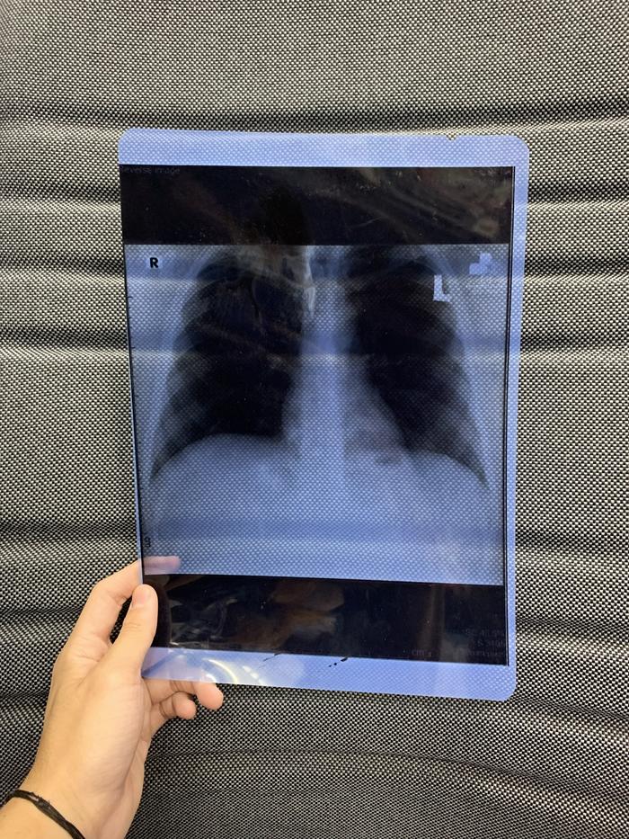 Jual Kertas print Ronsen rontgen blue film a4 x ray xray film - Jakarta ...