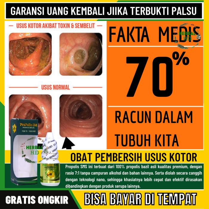 Jual Obat Herbal Pembersih Usus Kotor, Infeksi Usus, Usus Besar, Usus ...