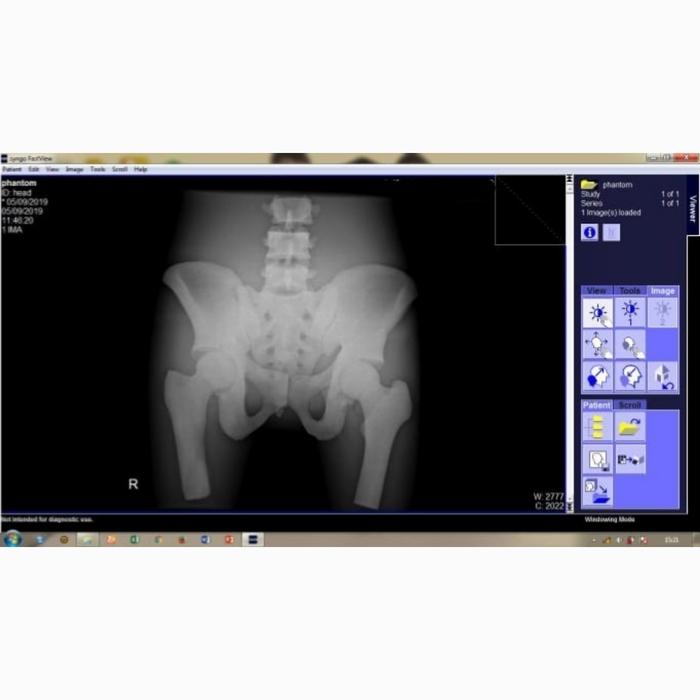 Jual Anthropomorphic Phantom Xray PELVIS Radiografi Radiography Imaging ...