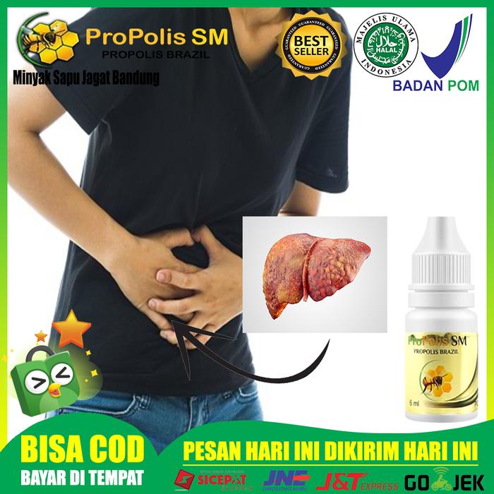 Promo Obat Tradisional Liver Kronis - Obat Sirosis Hati, Hepatitis ...