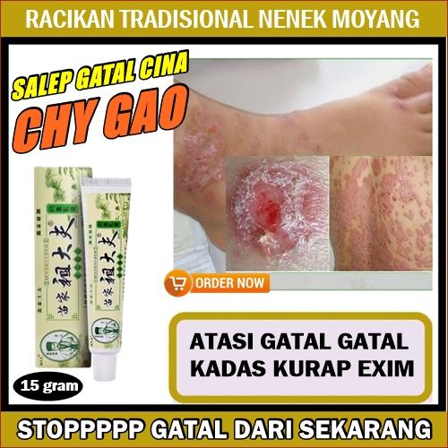 Promo salep gatal china kulit exim kadas kurap herpes ampuh obat chy ...