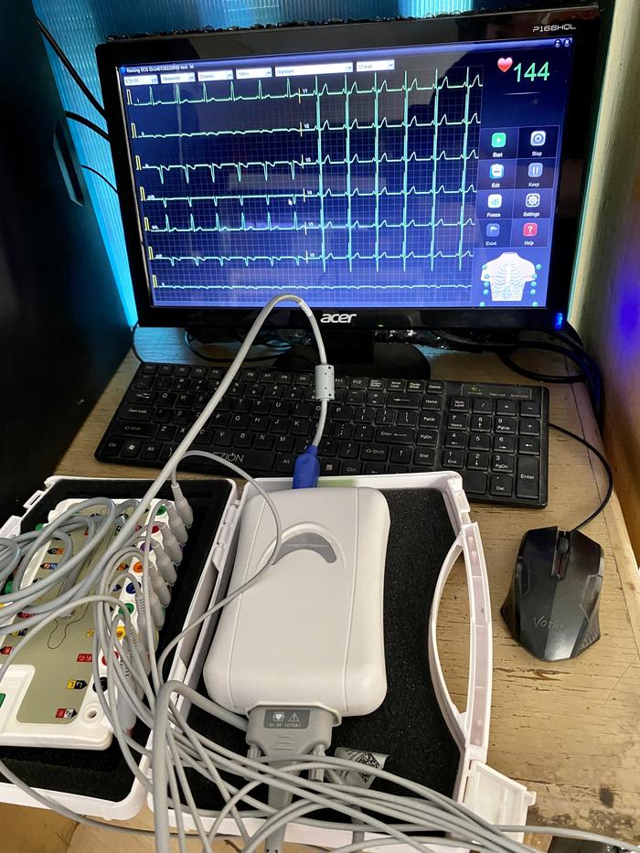 Promo PC ECG/ EKG LAPTOP PC MODEL SE1515 - Kab. Bogor - Nusantara Alkes ...