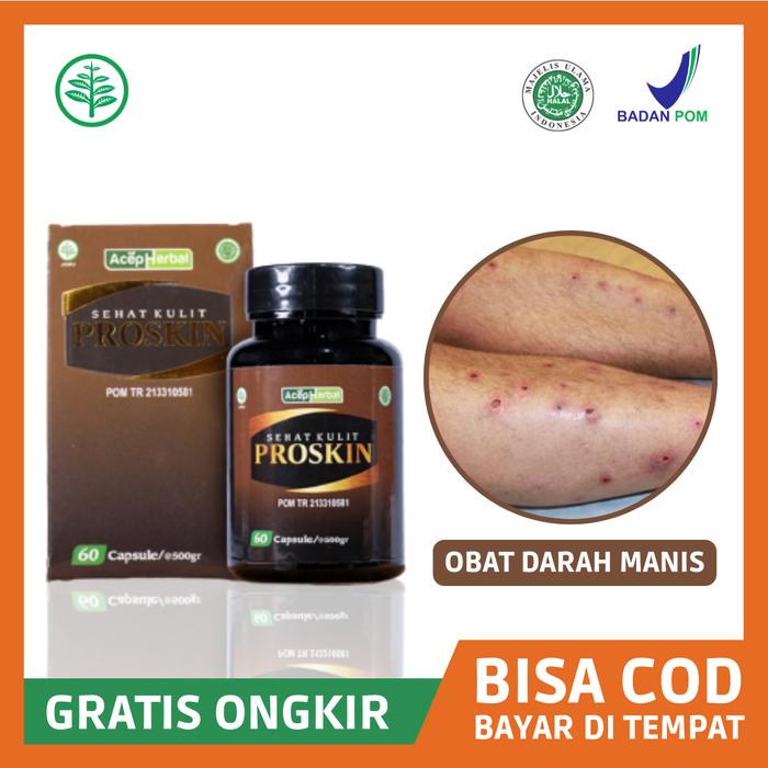 Jual PROSKIN Obat Darah Manis Bekas Koreng DiKulit Prurigo - Kota ...