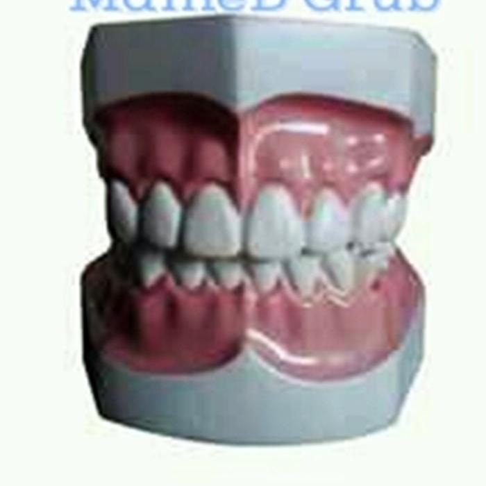 Jual Phantom Gigi / Phantom Dental Gigi Dewasa - Jakarta Pusat ...