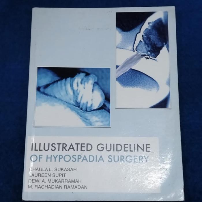 Jual Illustrated Guideline Of Hypospadia Surgery - Chaula Dkk Di Seller ...