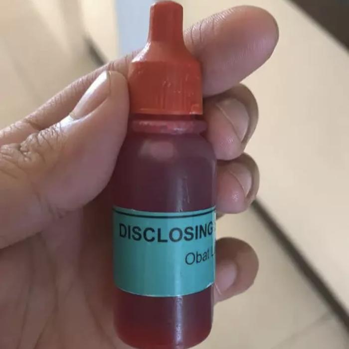 Jual Dental Disclosing agent cair/ Disclosing Solution pendeteksi plak ...
