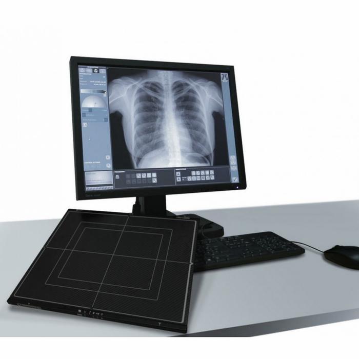 Jual DR Digital Radiologi Flat Panel Detector Wireless Radiology CR ...